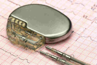 Implantable Cardioverter Defibrillator (ICD) - AF-ABLATION