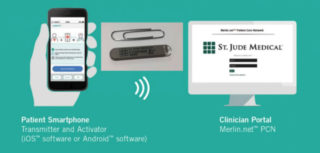 Implantable Loop Recorder - AF-ABLATION